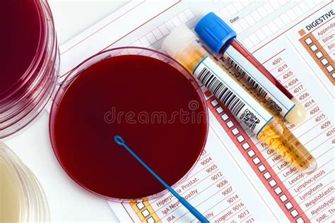 Medisch Rapport Met Petrischaal En Biologische Monsters In Buis Stock