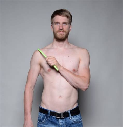 Infraspinatus Muscle Pain Trigger Points