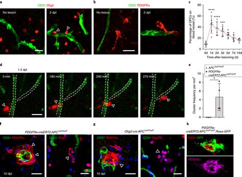 Opc Perivascular Clusters Following Demyelination Represent A Defective