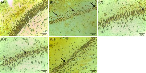 Bielchowsky Stain Histological Assessment ×400 A Control Download Scientific Diagram
