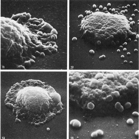 S 18 Scanning Electron Microscopy Isolated Nucleoli The Nucleoli