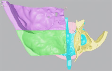 Stl File Highly Detailed 3d Printable Skull Model With Multiple