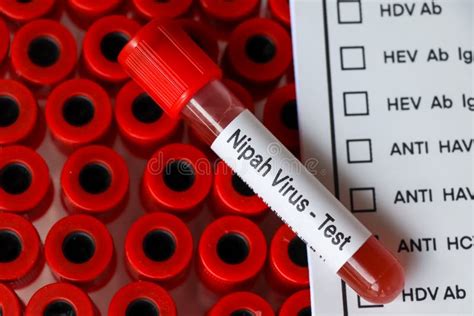 Nipah Virus Test To Look For Abnormalities From Blood Stock Image