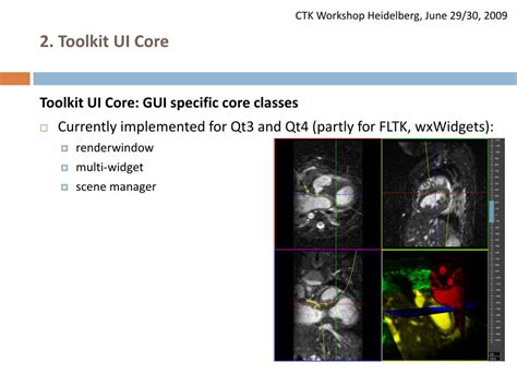 Ppt Medical Imaging Interaction Toolkit Powerpoint Presentation Free