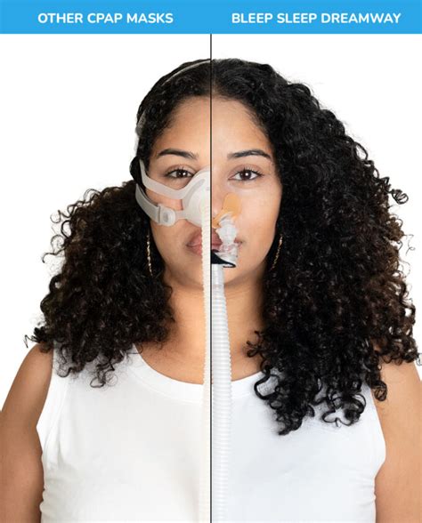 Bleep Sleep Dreamports® Starter Bundle Sureseal Cpap Masks And