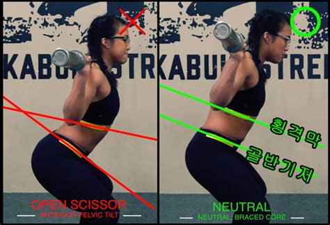 이두건염 재활의 전체적인 그림 운동 건강 아싸 에펨코리아