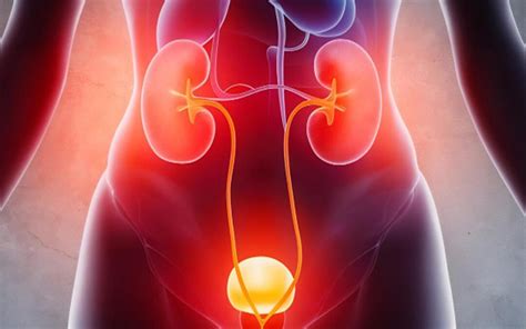 Urinary Tract Infection Archives Synlab Nigeria