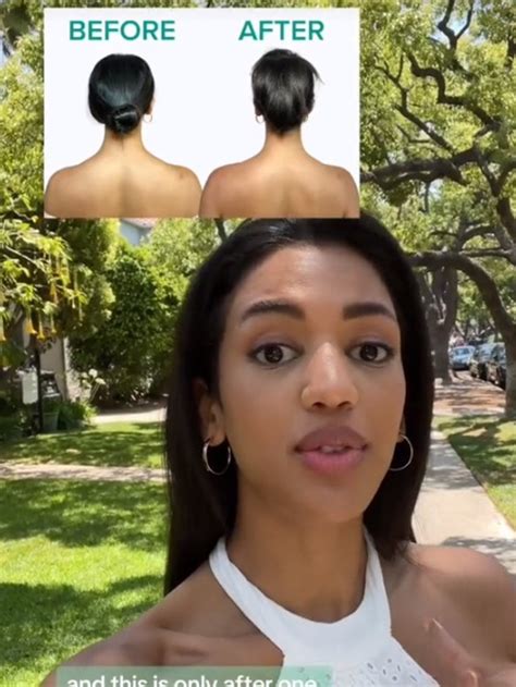 Barbie Botox Why People Are Taking Part In Bizarre New Trend NT News