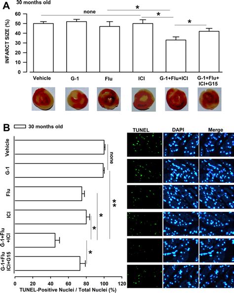 Effects Of G Protein Coupled Estrogen Receptor Gper Activation
