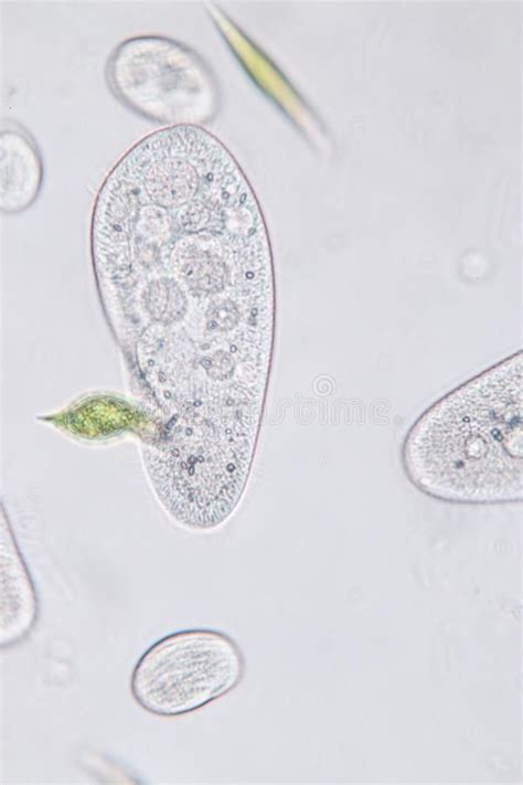Ciliates Under Microscope