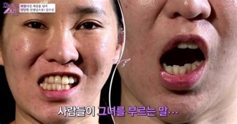 화이트스완 김수진 40일 치료로 완벽 변신 감동