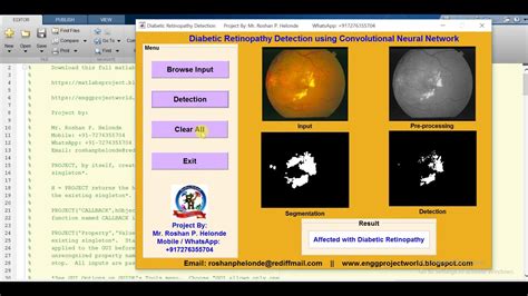 Matlab Code For Diabetic Retinopathy Detection Using Convolutional