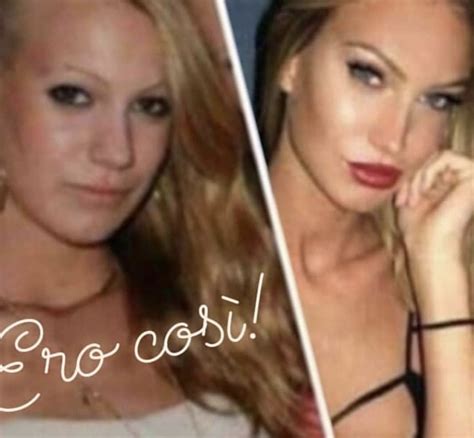 Taylor Mega Prima E Dopo I Ritocchini Estetici Leclatante