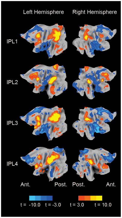 Whole Brain Connectivity Maps Based On Resting State Data The Seeds Download Scientific