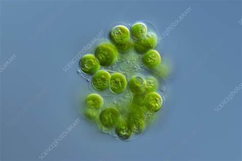 Botryococcus Algae Light Micrograph Stock Image C058 6645