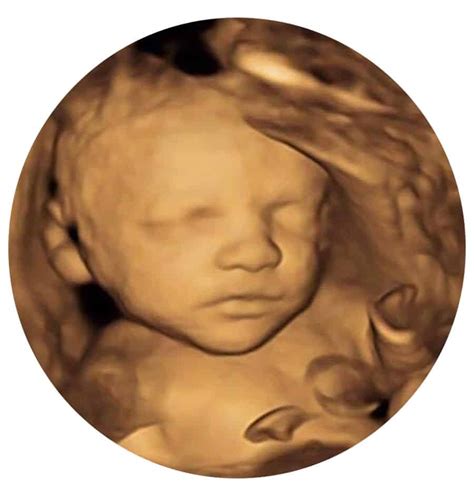 Cambridge Newmarket 4d Scan Now £85 Rrp £110