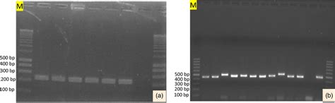 Representative Agarose Gel Electrophoresis Of Dna Amplification Product