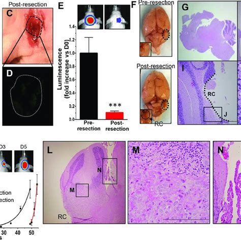 Fluorescence Guided Microsurgical Resection Reduces Volumes Of Download Scientific Diagram