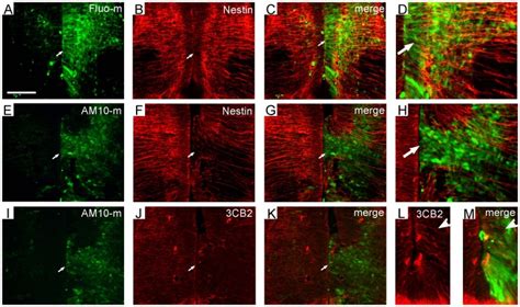 Adam10 Negatively Regulates Neuronal Differentiation During Spinal Cord