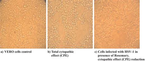 The Hsv 1 Cytopathic Effect And Its Inhibition By The Antioxidant