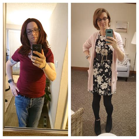Day 1 Vs Day 413 On Hrt It May Take Time But You Will Get To A