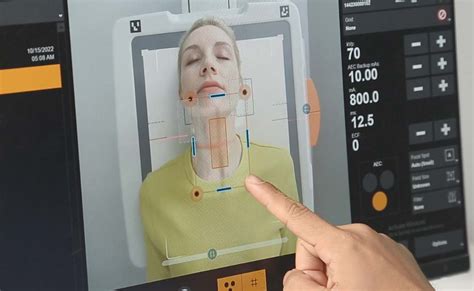 Carestream Offers Smart Assist Features On Drx Compass Ice