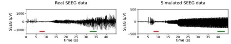 How Mathematical Models Help Us Understand Epileptic Seizures
