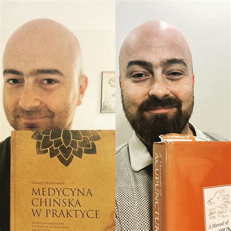 Michał Iwanicki Mpt Cmd Akupunktura Osteopatia Droga Środka Czerwiec 2017 Wtedy