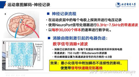 【脑机接口论文分享】一种引发触觉感觉的脑机接口改善了机器臂的控制能力 1 知乎