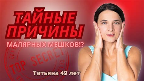 Разбор по фото - YouTube