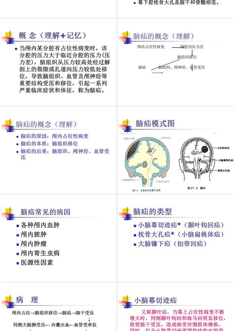 颅内压增高ppt模板 卡卡办公
