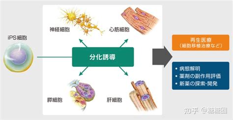 日本首例ips细胞移植治疗糖尿病，宣称比中国方法更高效，二者有何异同？ 知乎