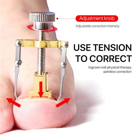 Инструмент для восстановления вросших ногтей и педикюра Aliexpress