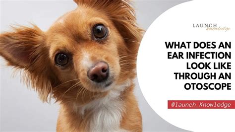 What Does An Ear Infection Look Like Through An Otoscope