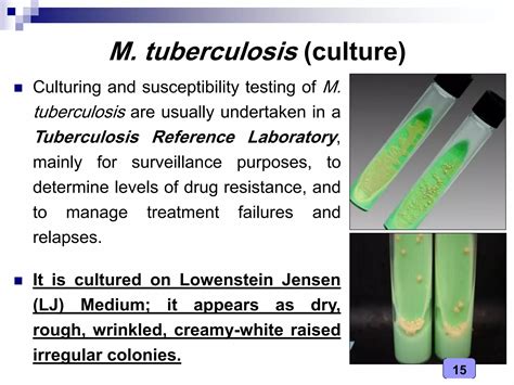 Medical Microbiology Laboratory Mycobacterium Spp Pdf