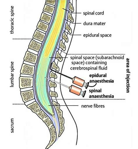 Epidural And Spinal Anesthesia Are Medical Knowledge