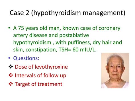 Hypothyroidism Management Ppt Download