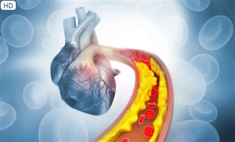 Chuyên Gia 7 Loại Thực Phẩm Hàng đầu Giúp Giảm Cholesterol Ngăn Ngừa