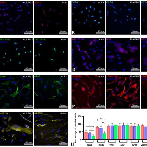 differential gene expression analysis in the tcga gbm rna seq dataset