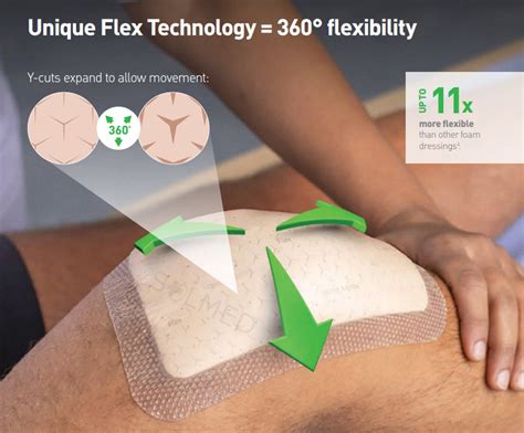 Mepilex Border Flex Solmed Medical Supplies Solmed Medical Supplies