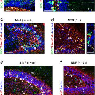Neurogenesis In The Dentate Gyrus Ceases By 10 Years Of Age In Naked