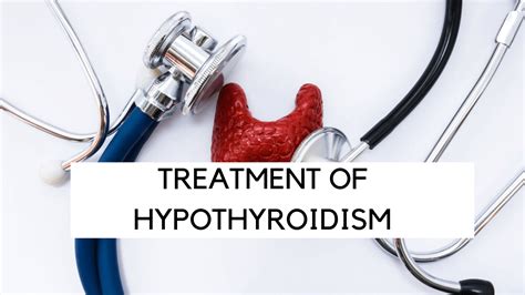 Treatment Of Hypothyroidism Dr Shabnam Das Kar Md
