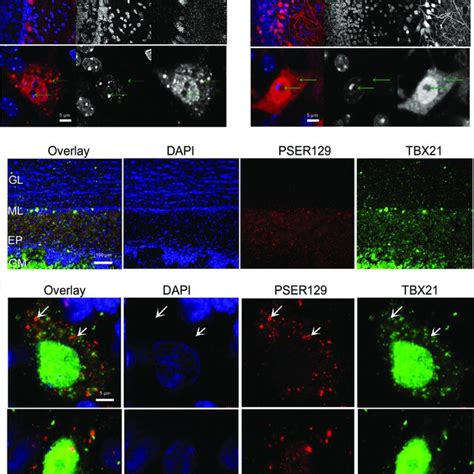 Pdf Distribution Of Phosphorylated Alpha Synuclein In Non Diseased