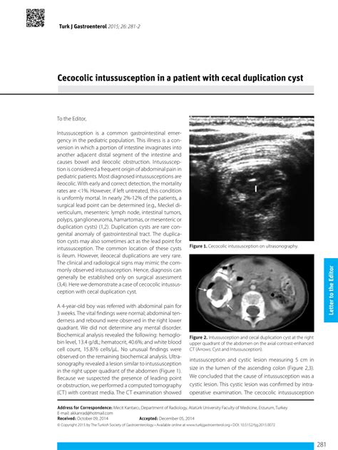 Pdf Cecocolic Intussusception In A Patient With Cecal Duplication Cyst