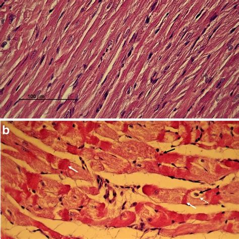 99mtc Pyp Accumulation In The Male And Female Rat Myocardium After 24 H Download Scientific