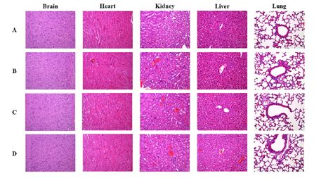 Effects Of Spe Treatment On Histology Of The Brain Heart Liver Download Scientific Diagram