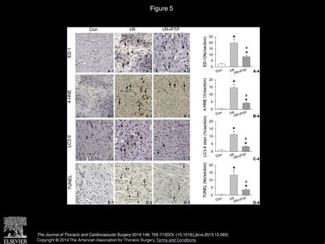 Progressive Thermopreconditioning Attenuates Rat Cardiac Ischemia