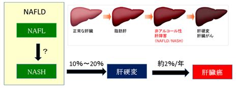非アルコール性脂肪性肝疾患｜かい内科クリニック｜大阪狭山市・富田林市