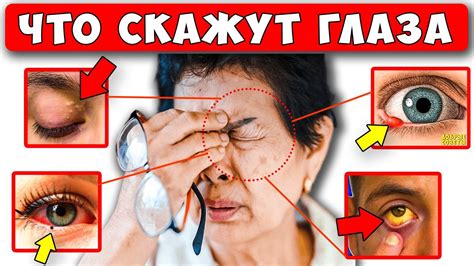 Болезни по ГЛАЗАМ 15 признаков которые расскажут о Проблемах Youtube