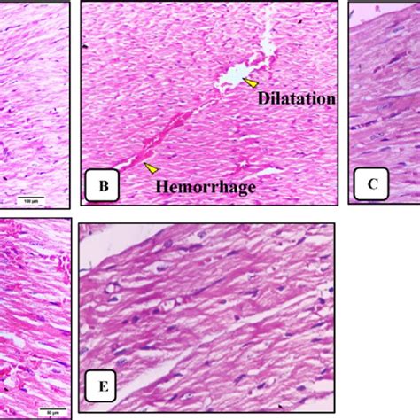 Photomicrographs Of Cross Sections Of Heart Stained With Hande In Rats Of